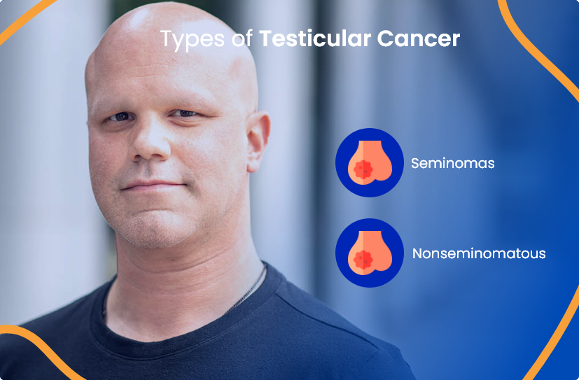 Diagrama De Cancer Testicular Diagrama De Cancer Testicular