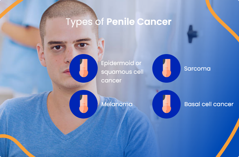 Penile Cancer Types Symptoms Treatment Brooksville ACTC